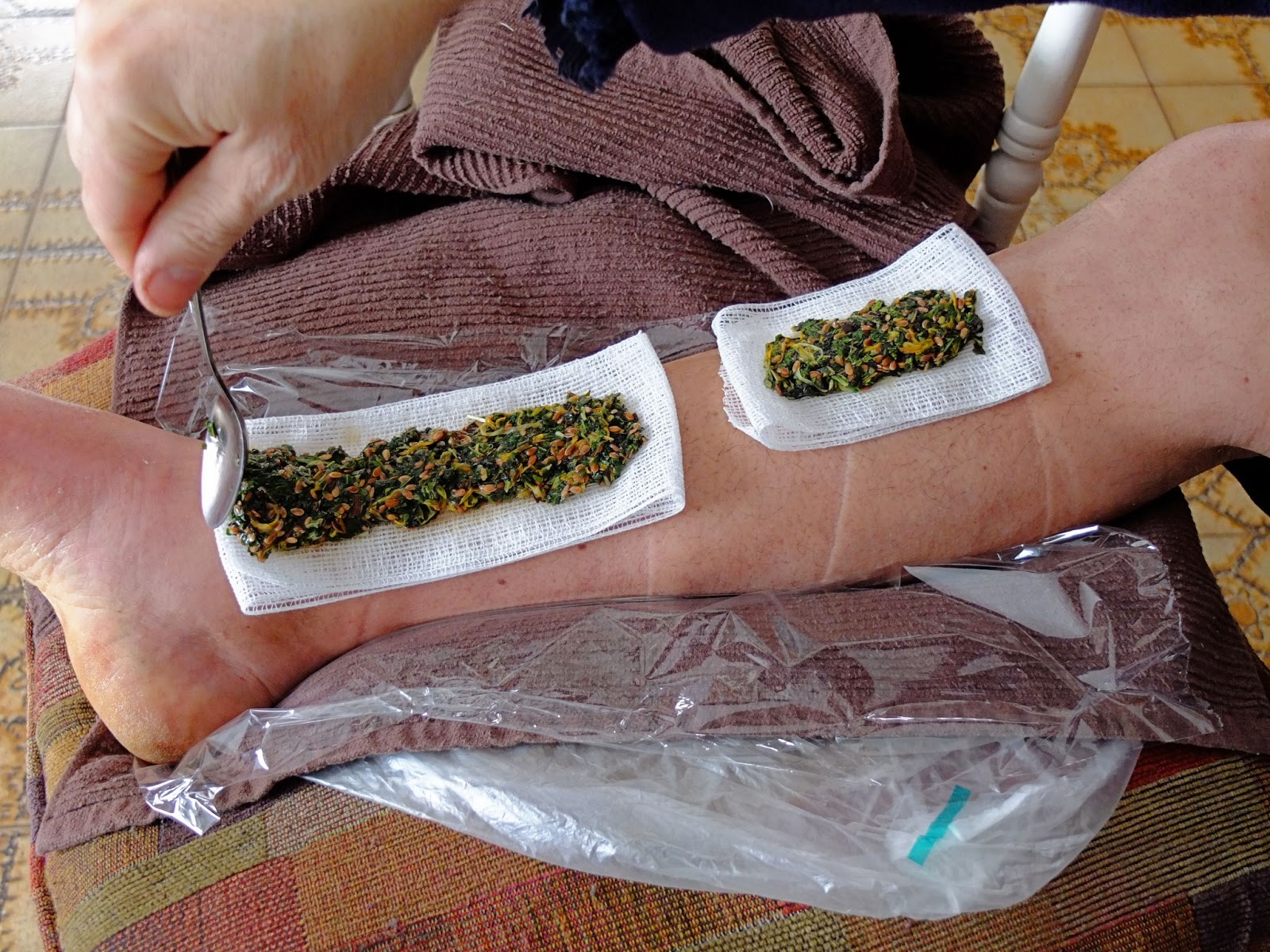 Breath Work and Stress | Doctors Beyond Medicine